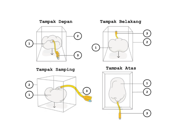 Inovasi Alat Peraga Pelatihan Nefrolitotomi Perkutan Berbasis Material ...
